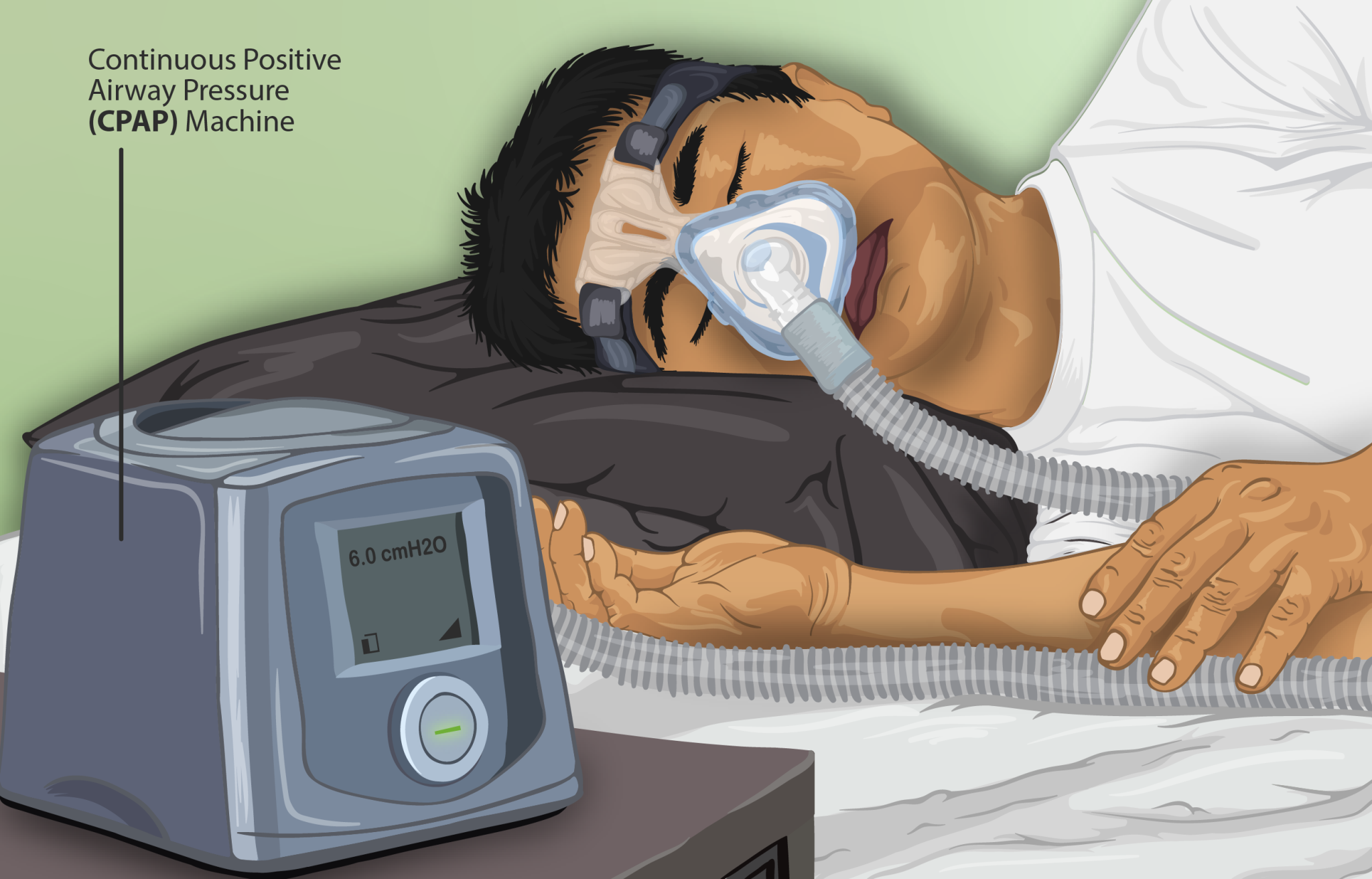 Understanding Sleep Apnea and Treatment Options - Best Ear Nose ...